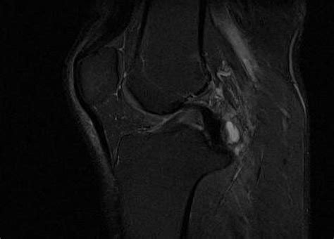 Francescoacl X Ray · Datasets At Hugging Face