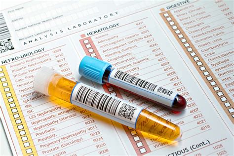 Analyse Durine Ecbu Comprendre Les Résultats Santé Magazine