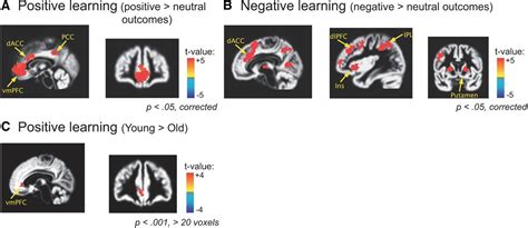 Reduced Striatal Responses To Reward Prediction Errors In Older Compared With Younger Adults