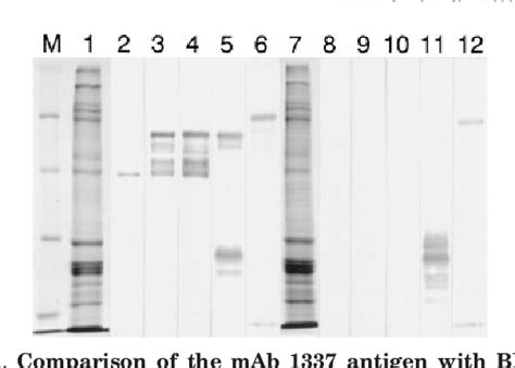Figure 2 From Cleavage Of Bp180 A 180 Kda Bullous Pemphigoid Antigen
