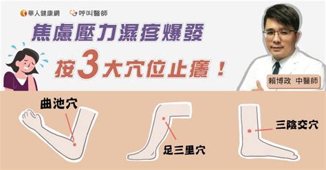 焦慮壓力濕疹爆發，按3大穴位止癢！中醫：濕疹分內濕外濕，用藥大不同 華人健康網 專業即時優質的健康新聞及資訊分享平台業即時優質的健康