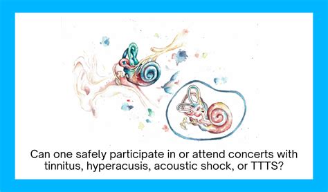 Can One Safely Participate In Or Attend Concerts With Tinnitus