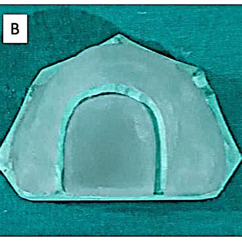 Record Base Fabricated By Technique 2 Group C A The Cut Below 15 Download Scientific