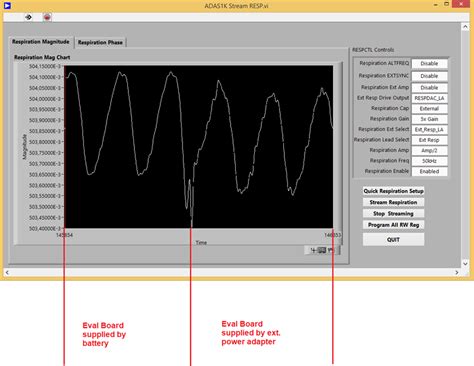 Adas1000 4 Distortion Of Respiration Signal When Using Ext Power