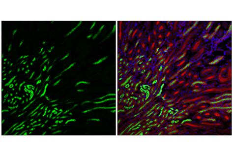 Osteopontin SPP1 E4O2F Rabbit MAb Cell Signaling Technology