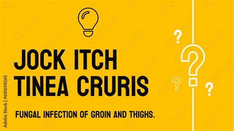 Jock Itch Tinea Cruris A Fungal Infection In The Groin Area Stock