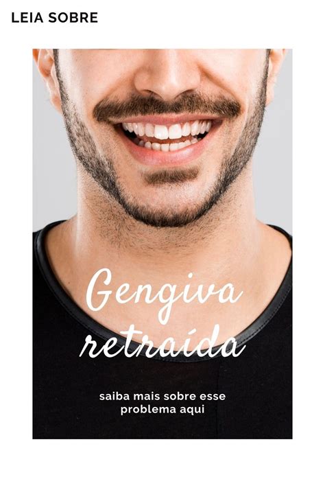 Gengiva Retraída Saiba Mais Sobre Esse Problema Aqui