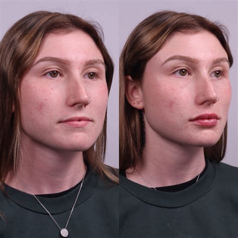 Cosmetic Doctor Brisbane Leading Non Surgical Cosmetic Clinics In