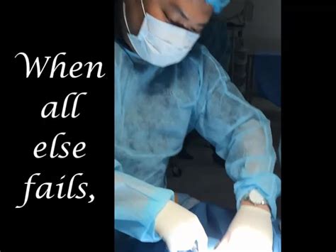 Paulo San Pedro On Linkedin Cico Fona Cricothyroidotomy Scalpelbougie Sbt Algorithm