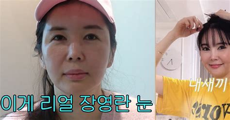 장영란 ★ 최초 성형 비포and애프터 공개 25년만 6번째 수술 고양이 눈 됐다 A급 장영란 [종합]