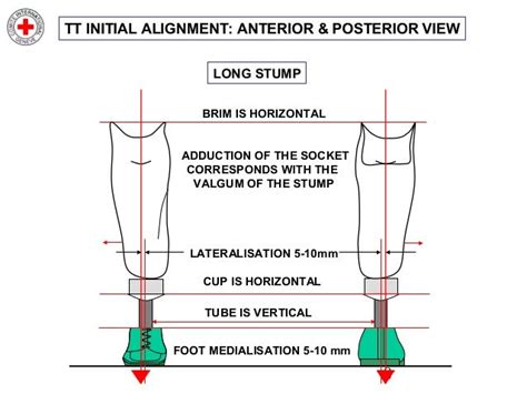 Transtibial Initial Alignment