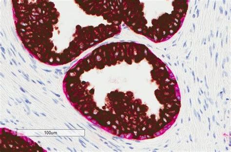 Automated Sequential Chromogenic Ihc Double Staining With Two Hrp Substrates Biorxiv