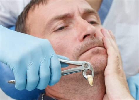 Day By Day Tooth Extraction Healing Stages With Pictures 2023 Go Fix
