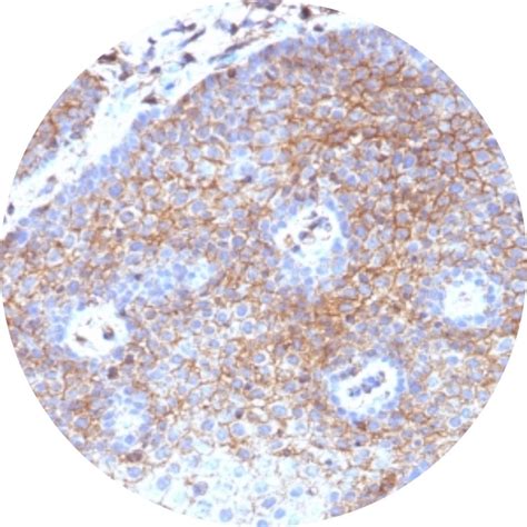 Control Slides Ihc Beta 2 Microglobulin B2m Rankin Biomedical