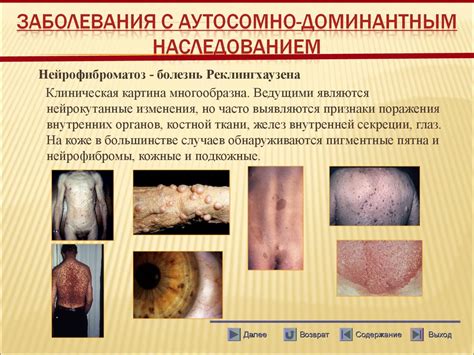 Генетика человека Генные болезни презентация онлайн