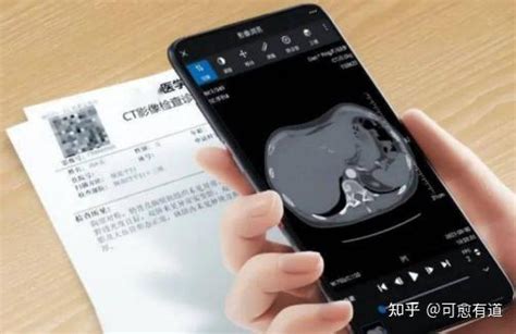 什么是DICOM格式医学影像？如何获取？ - 知乎
