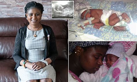 Woman With TWO Vaginas And Wombs Says Doctors Failed To Spot Her