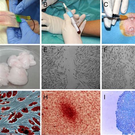 Microscopic Wound Healing Epithelialization Rate Evaluation A