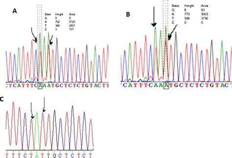 A And B The Sequence Of Two Bd Patients With The T A Alteration At Download Scientific