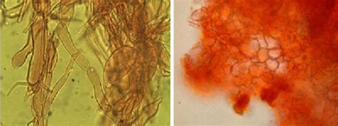 Microscopia De Setas Las Hifas