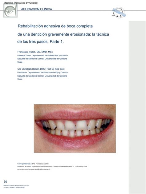 full mouth adhesive rehabilitation of a severely eroded dentition the