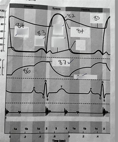 Labeling Ekg Diagram Quizlet