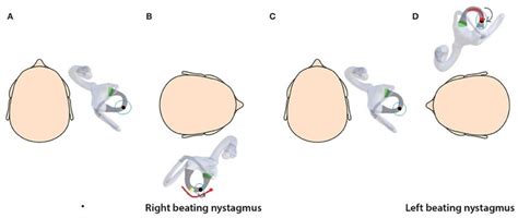 양성 발작성 현기증 Bppv 네이버 블로그