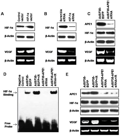 APE regulates VEGF expression through HIF α HIF α vector A or Download Scientific Diagram
