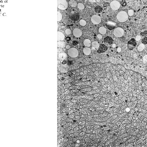 Electron Micrograph Of A Bacteria Filled Bacteriocyte Embedded Between