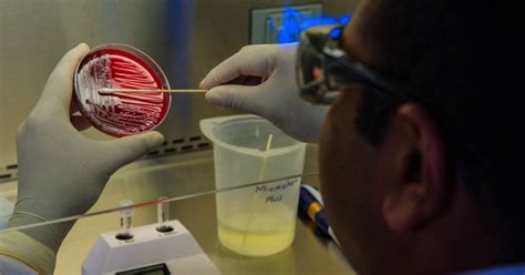 Expertos Explican Qué Es La Bacteria Vibrio Vulnificus Conocida Como