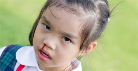 孩子鼻出血正确处理方法腾讯新闻