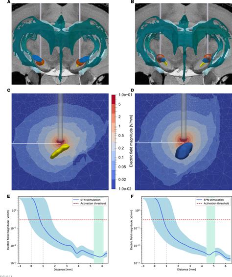 Figure 3 From Subthalamic Nucleus But Not Entopeduncular Nucleus Deep