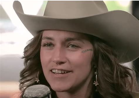 Sierra Ferrells Teeth Before And Afters Lema