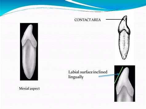 Mandibular Central Incisor Pptx
