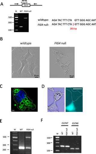 The Chloride Antiporter Clcn7 Is A Modifier Of Lysosome Dysfunction In