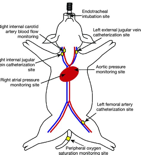 An Electronic Tipped Catheter Mikro Tip Transducer Millar