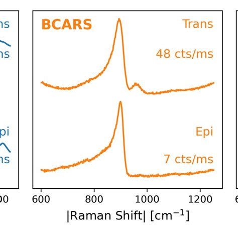 comparison of the transmission trans upper row and epi detected