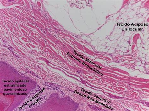 Tecido Muscular Histologia E Embriologia