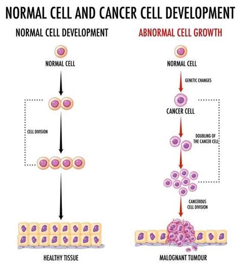 Lyrica To Neurontin Conversion Chart And Safe Switch Steps