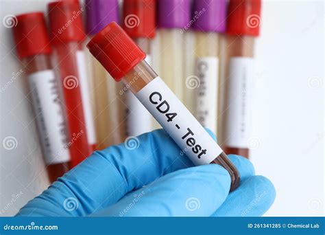 Cd4 Test To Look For Abnormalities From Blood Stock Image Image Of