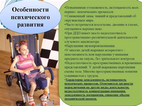 Дети с нарушением опорно двигательного аппарата Online Presentation