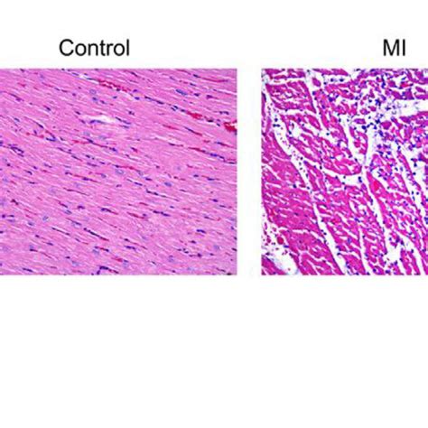 β Catenin Upregulation Reduced Apoptosis In The Cardiac Tissue Of Mi