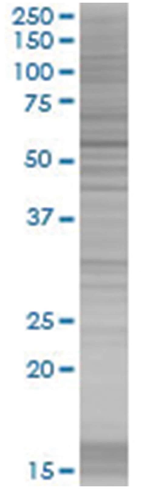 Znf671 293t Cell Overexpression Lysate Denatured Abnova 100μl