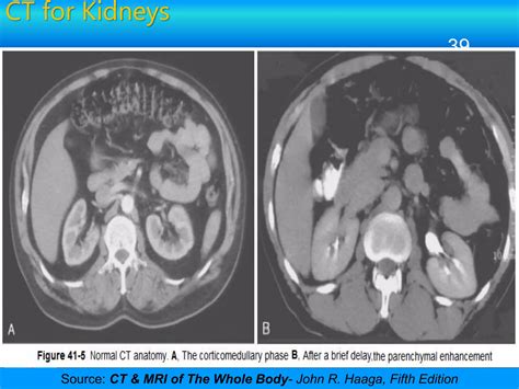Ct Procedure Of Abdomen And Pelvis Ppt
