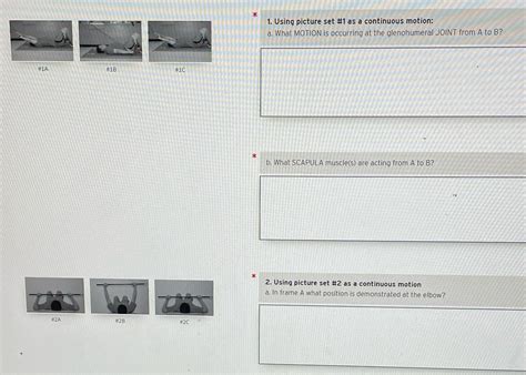 Solved This Lab Is On The Scapula K 1 Using Picture Set 1 As A