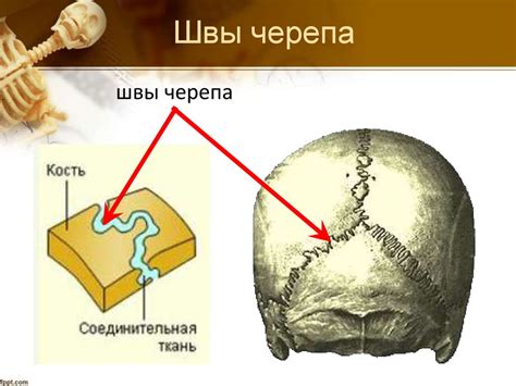 Кости черепа - презентация онлайн