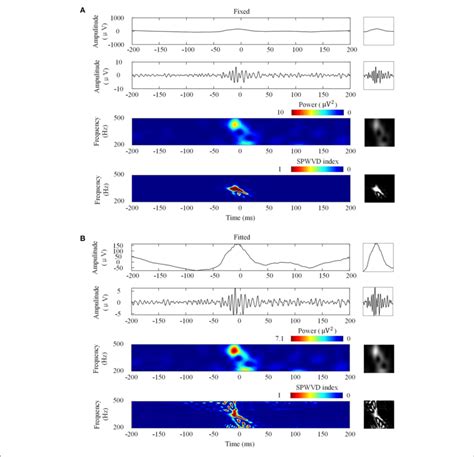 Four Fast Ripples Frs Image Transformations Left Transformations Download Scientific