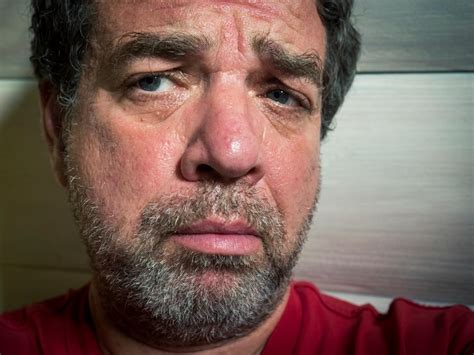 What Is Red Face From Alcohol And How Do You Prevent It United