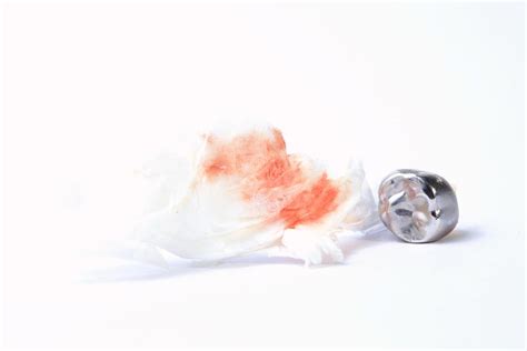 What Does Implantation Bleeding Look Like Charlies Magazines