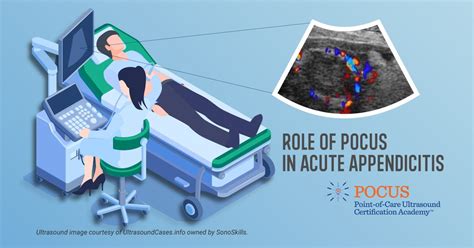 Graded Compression Ultrasound